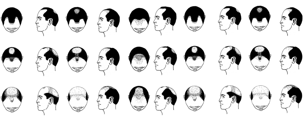 IN PRAISE OF THE PROUDLY BALD SKATEBOARDER - Jenkem Magazine