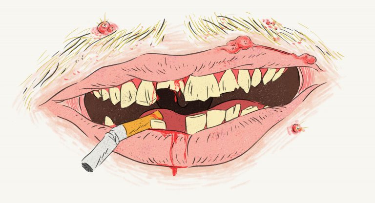 THE JENKEM GUIDE TO SKATE INJURIES - Jenkem Magazine