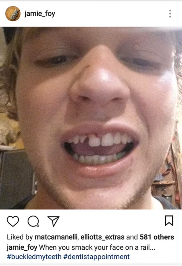 jamiefoyteeth - Jenkem Magazine