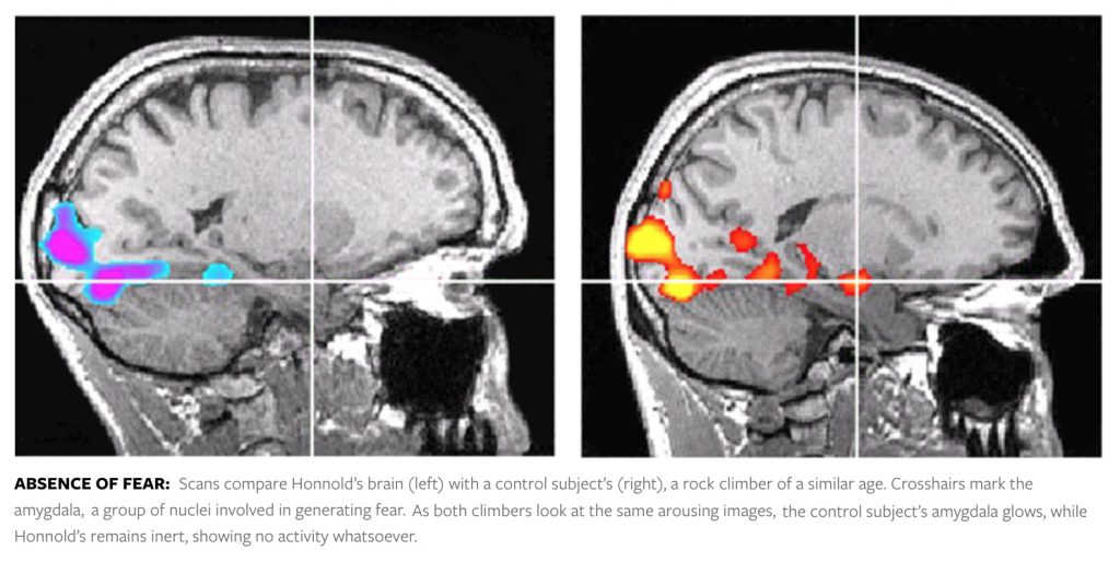 THE SCIENCE BEHIND OVERCOMING FEAR IN SKATING - Jenkem Magazine